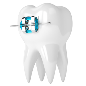 Starlight Dental Clinic near me in Prestons | Crown Dental Hoxton Park