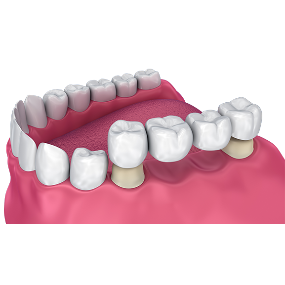 Starlight Dental Clinic in Prestons | Crown Dental Hoxton Park