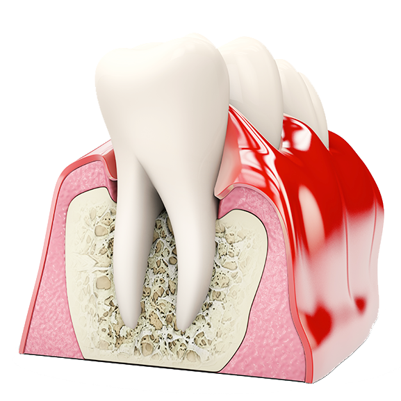 Starlight Dental Clinic in Prestons | Crown Dental Hoxton Park