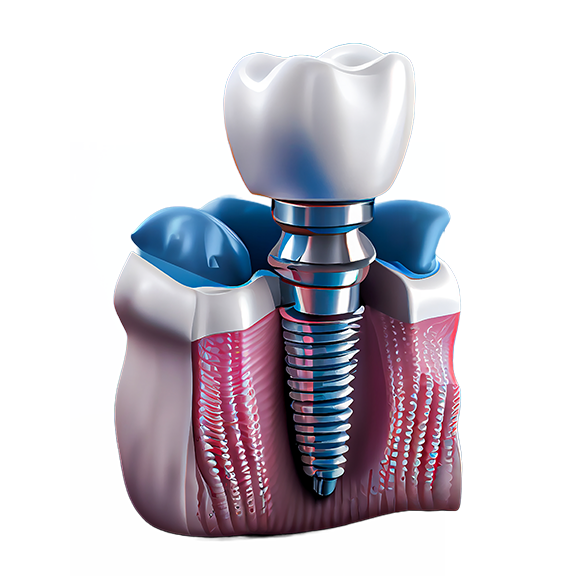 Starlight Dental Clinic near me in Prestons | Crown Dental Hoxton Park