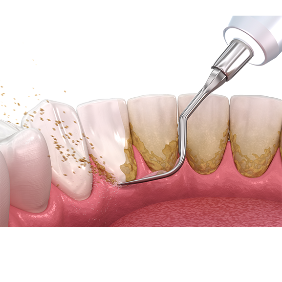 Starlight Dental Clinic in Prestons | Crown Dental Hoxton Park