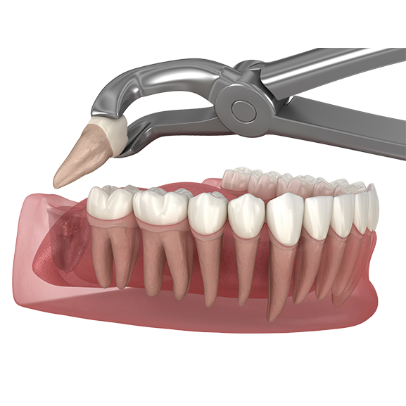 Starlight Dental Clinic in Prestons | Crown Dental Hoxton Park