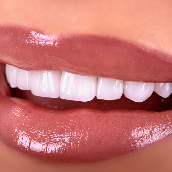 Starlight Dental Clinic in Prestons | Crown Dental Hoxton Park