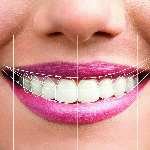 Starlight Dental Clinic near me in Prestons | Crown Dental Hoxton Park